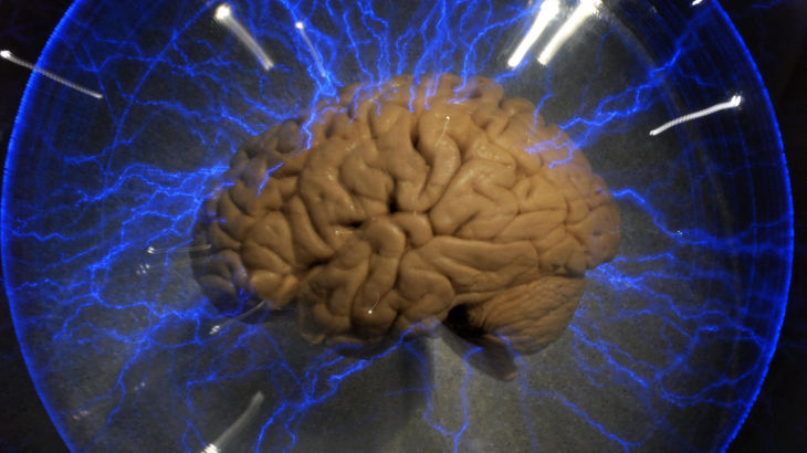 Total Recall: How the Brain Processes Color and Motion | Lunatic ...
