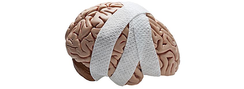 The Ever Plastic Brain and Intellectual Disabilities | Lunatic Laboratories