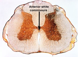 Know your spinal cord – The anterior white commissure | Lunatic ...
