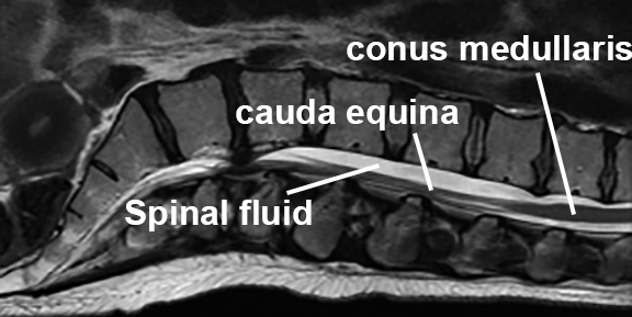 Know your spinal cord – The cauda equina | Lunatic Laboratories