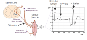 Know your spinal cord – The H-reflex | Lunatic Laboratories