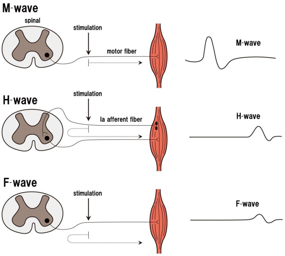 Know your spinal cord – The F-wave | Lunatic Laboratories