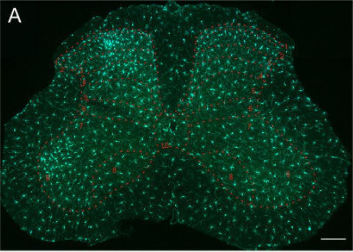 Know your spinal cord – Microglia | Lunatic Laboratories