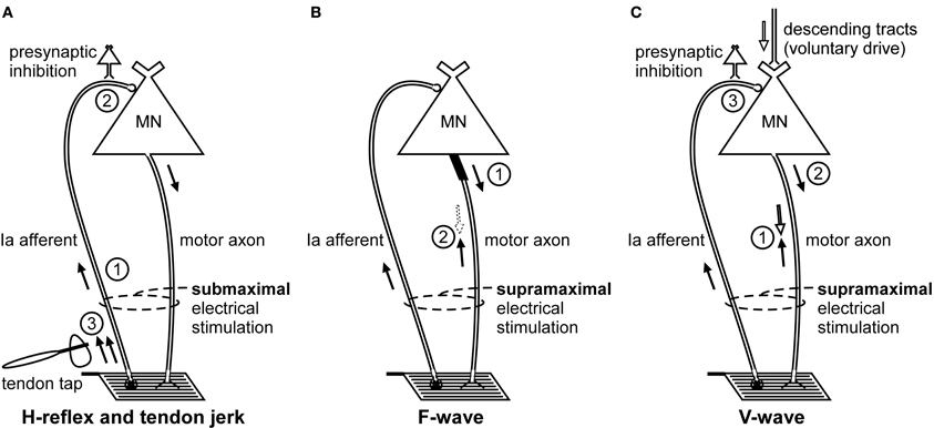 Know your spinal cord – The V-wave | Lunatic Laboratories
