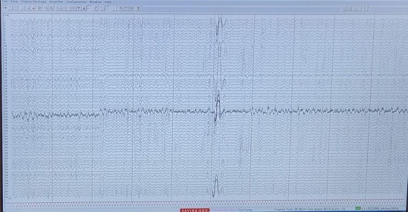 How to process EEG data | Lunatic Laboratories
